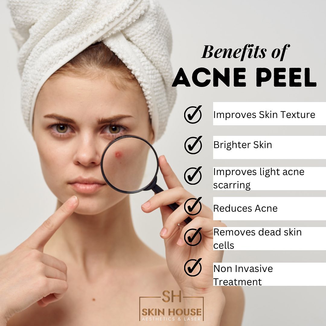 About us - 10 years of experience - Skin House Luton