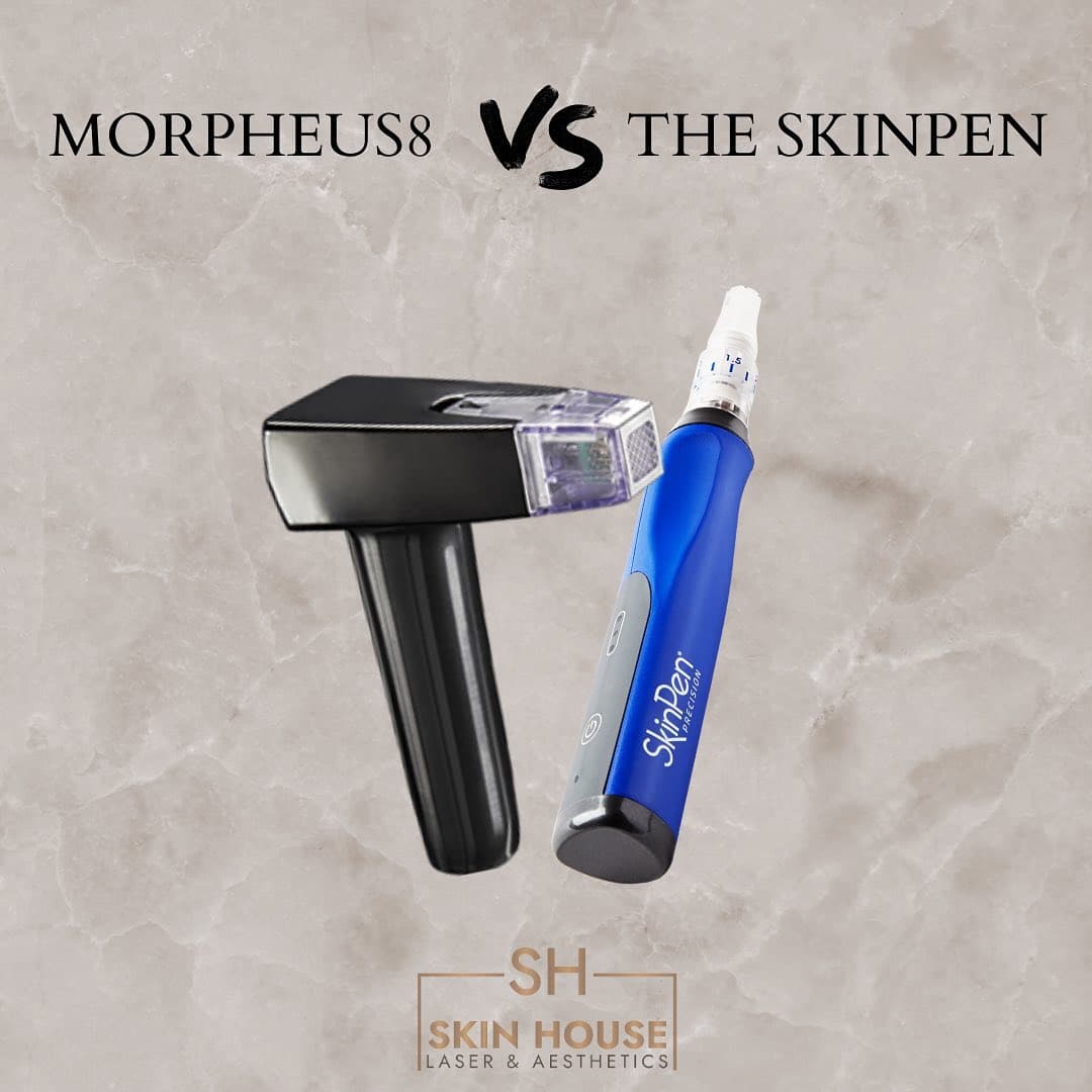 Men Laser Hair Removal in Luton - 40% OFF - Skin House Luton