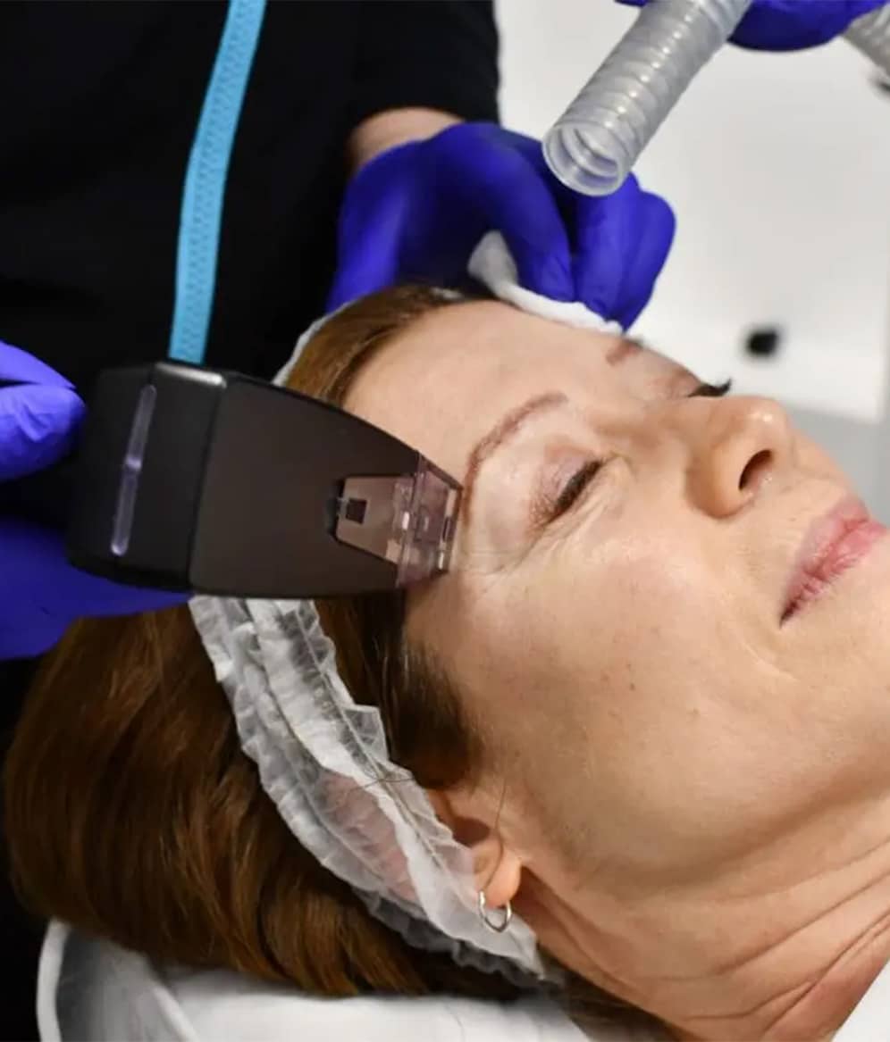 Skin House Luton | Aesthetics & Laser Clinic | Hair Removal Treatments