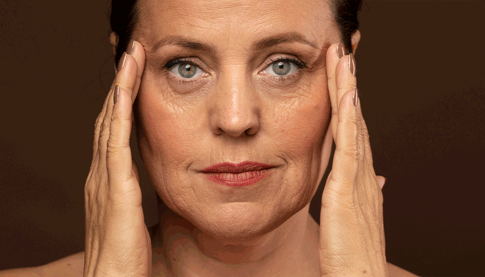 Age spots at Skin House Luton - Elevate Your Features