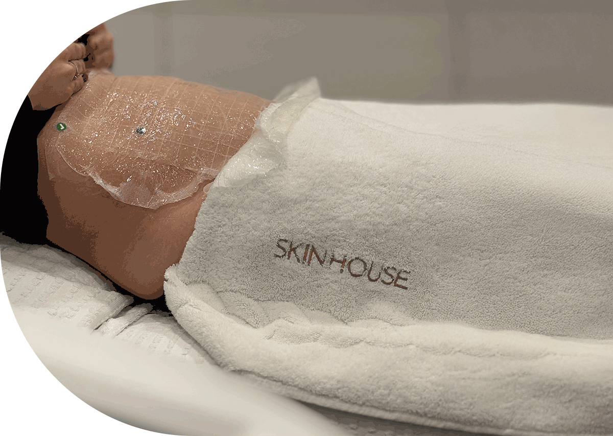 CoolTech Fat Freezing in Luton - Enjoy the offer for Fat treatment