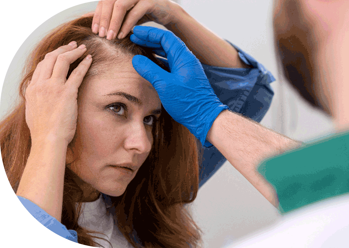 PRP Hair Thinning at Skin House Luton - Elevate Your Features