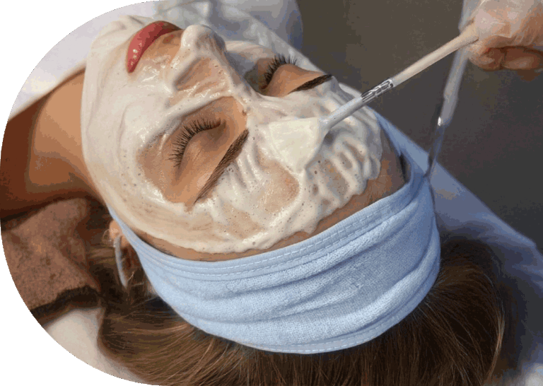 Melanostop peels Therapy in Luton - Skin House